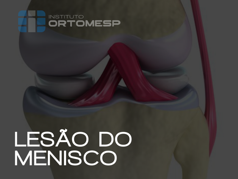 O que é lesão do menisco e como isso pode influenciar a vida de um ...